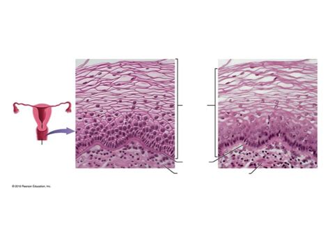 Nonkeratinized Stratified Squamous Epithelium Diagram Quizlet
