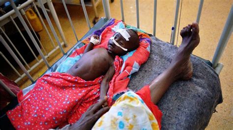 La Crise Alimentaire En Somalie A Fait 258 000 Morts En Moins De Deux Ans