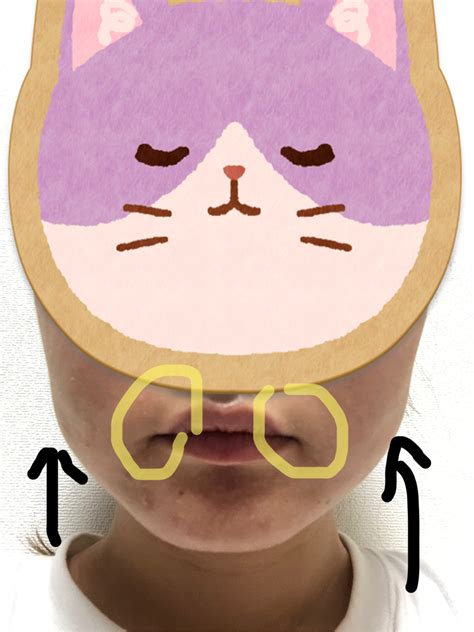 의사에게 물어보세요 자르지 않는 작은 강남언니 1등 성형수술and피부시술 정보앱