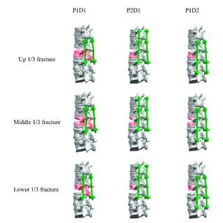 Models Of Different Surgical Strategies Download Scientific Diagram