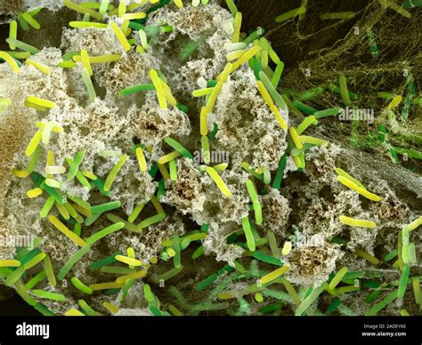 Pseudomonas Aeruginosa Bacteria Coloured Scanning Electron Micrograph Sem These Gram