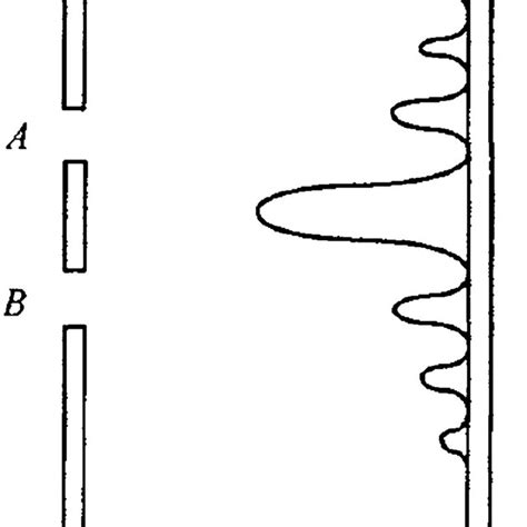 Aoota Classification System Type 43 Distal Tibial Fracture Download