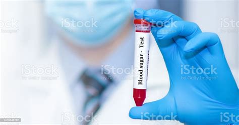 설탕 검사로 테스트 혈액 샘플 튜브를 들고 있는 의사 건강 검진에 대한 스톡 사진 및 기타 이미지 건강 검진 건강 진단