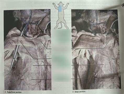 Superficial And Deep Portion Diagram Quizlet