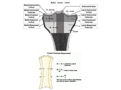 Cortical Thickness Measurement [9] Download Scientific Diagram