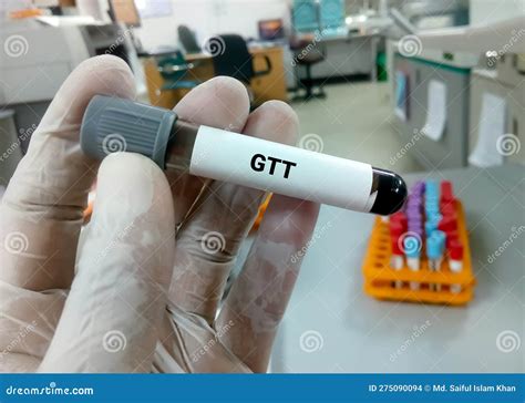 Technician Or Scientist Hold A Sample Tube Of Glucose Tolerance Test Or