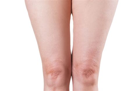 여성 다리에 연약한 피부 흰색 배경에 고립 된 노인의 무릎 과체중에 대한 스톡 사진 및 기타 이미지 과체중 노인 노화