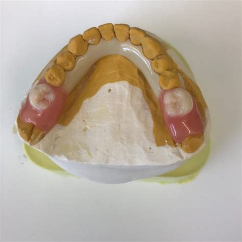 BioDentaplast 2 - bredent UK