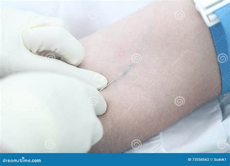 Medische Verrichting Intraveneuze Injectie Grote Details Stock Foto
