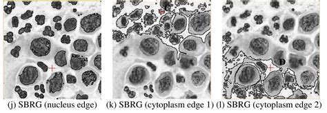 figure 7 automated edge detection technique for pap smear
