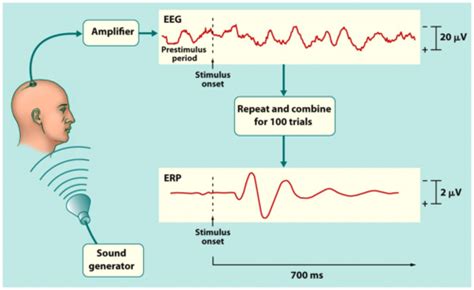 7 Eeg And Event Related Potentials With A Focus On Language Flashcards