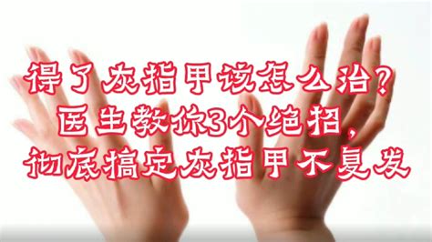 得了灰指甲该怎么治医生教你3个绝招彻底搞定灰指甲不复发 健康 科普 灰指甲 新浪新闻