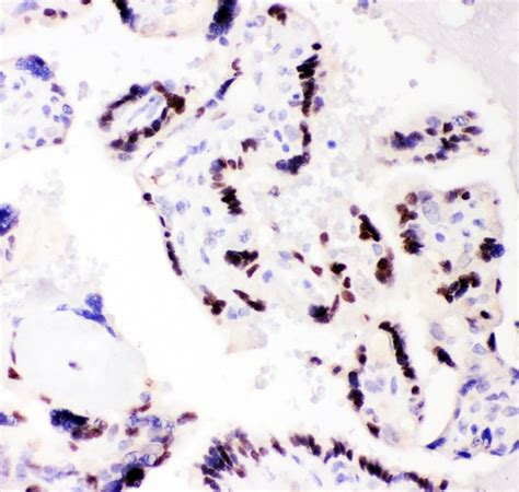Anti C Ebp Beta Cebpb Antibody Rabbit Anti Human Polyclonal Lsbio