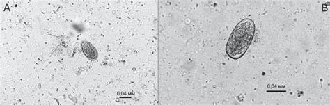 Eggs Of Trichostrongylus Sp From American Bison Of Prioksko Terrasny Download Scientific
