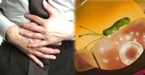 위암 재발도 헬리코박터가 원인