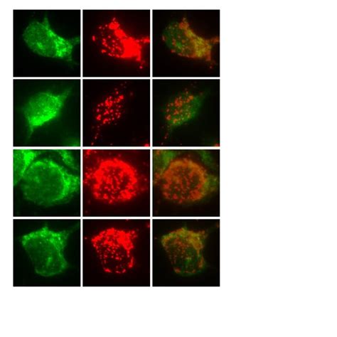 Pacap 27 And Pacap 38 Enhanced Neuroprotective Factor Expression