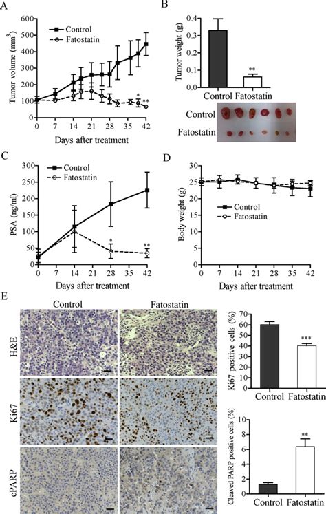 Fatostatin Displays High Anti Tumor Activity In Prostate Cancer By Blocking Srebp Regulated