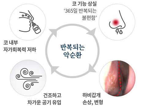 라경찬한의원 비염 한의원 축농증 한의원 후비루 치료 비염 치료 신논현역 한의원