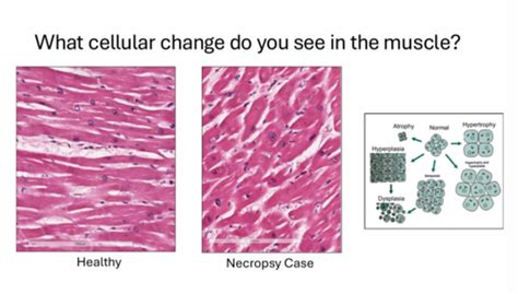 Term 2 Lesson 108 Disturbances Of Cell Growth And Neoplastic Disease Flashcards Quizlet