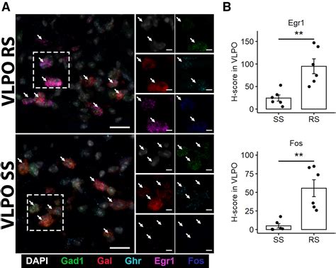 single nucleus rna seq identifies one galanin neuronal subtype in mouse