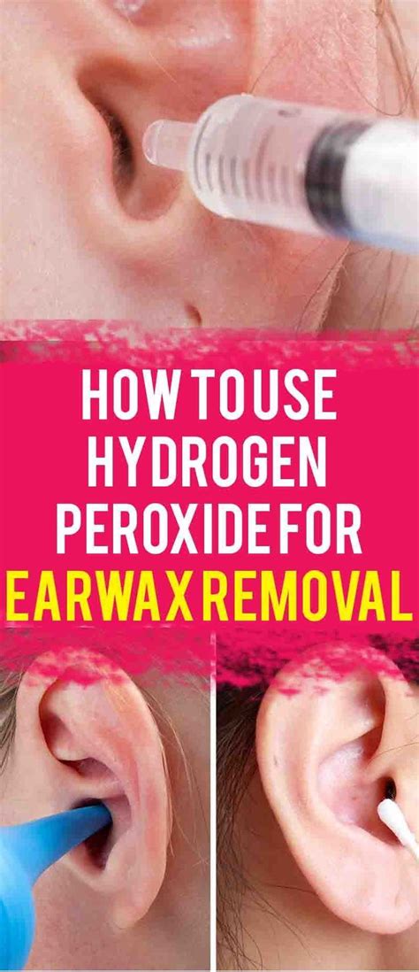 How To Use Hydrogen Peroxide To Remove Ear Wax Healthy Lifestyle