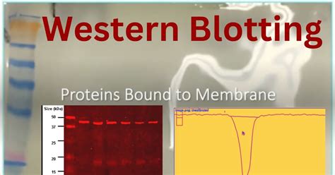 Step By Step Guide To Quantifying Western Blot Protein Bands Tools And