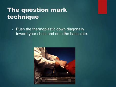 Patient Positioning And Immobilization Devices In Radiotherapy Planning Pptx