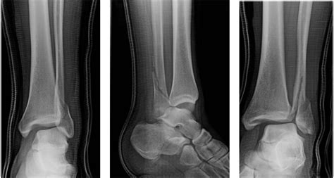 The Orthopod