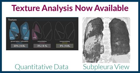 Texture Analysis