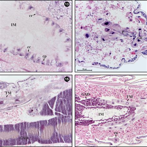 Prepupa Y Pupa De Phyllocnistis Citrella 13 Prepupa Corte Sagital Download Scientific
