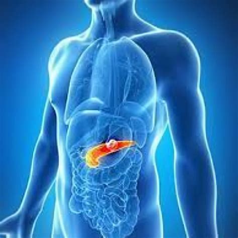 Pancreatic Cancer Prediction Dataset Kaggle