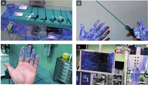 Mr Application For Surgical Assistance Spatial Detection Of The