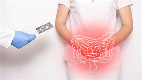 CÁncer De Colon SÍntomas Para Detectarlo A Tiempo Y Recomendaciones