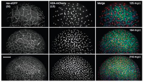Biophotonics Review Combining Digital Scanned Laser Light Sheet Fluorescence Microscopy With