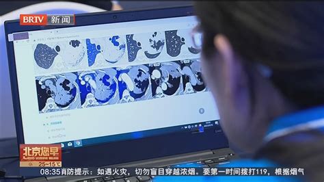 2023年全国结核病临床诊疗技能竞赛总决赛圆满收官北京时间