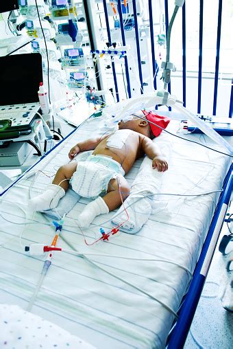 병원 중환자실의 인공호흡기에 걸린 중병에 걸린 아기 신생아 집중치료실에 대한 스톡 사진 및 기타 이미지 신생아 집중치료실