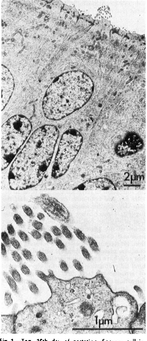 Utricular Macula Semantic Scholar