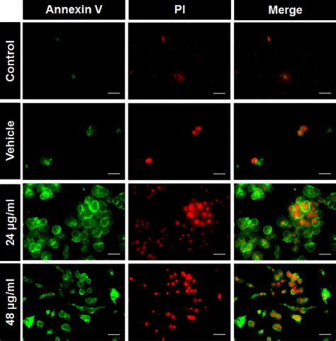 Annexin V PI Assay Demonstrating Cell Apoptosis Induced By Compound1