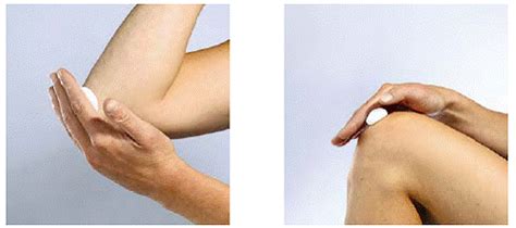 Olux E Clobetasol Propionate Foam Side Effects Uses Dosage Interactions Warnings