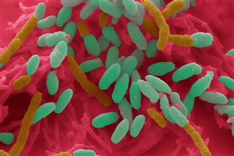 Vibrio Detection Lyokit Hygiena