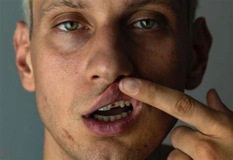 Прокуратурата в Пловдив разследва малтретиране на мъж в дискотека Информационна агенция ПИК