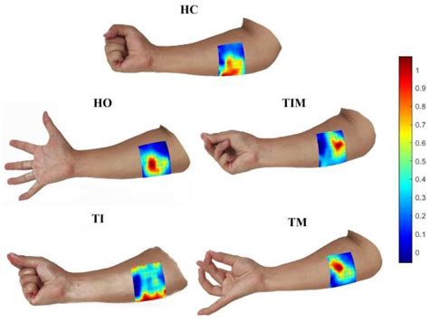 hand gesture recognition based on high density myoelectricity in forearm flexors in humans