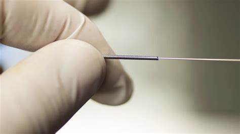 Functional Dry Needling For Pain Relief Range Of Motion Morristown