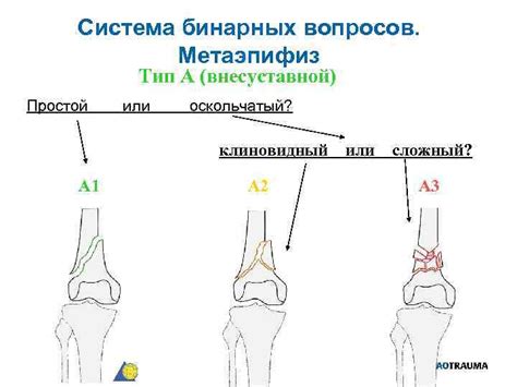 Ao Asif универсальная классификация переломов длинных костей Содержание