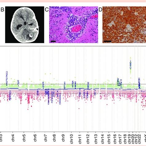 Minimal Set Of Key Radiological Pathological And Molecular Findings