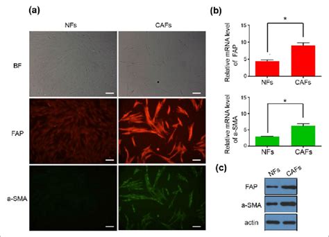 Isolation Of Fibroblast From Human Epithelial Ovarian Tissues A Download Scientific Diagram
