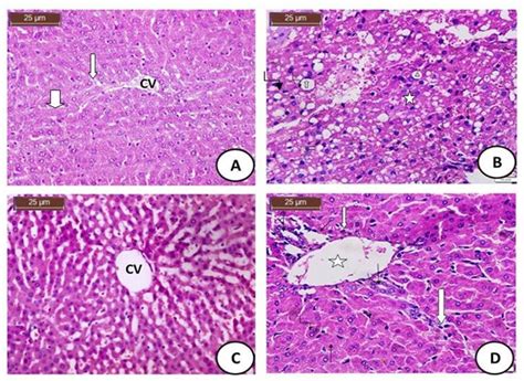 Effect Of Cadmium And Resveratrol On Hepatic Tissues A Control Download Scientific Diagram