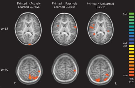 Direct Contrasts Of Perception Of Printed Letters Perception Of