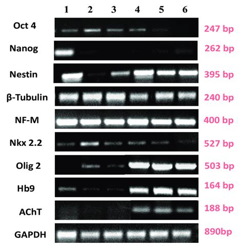 Rt Pcr Analysis Showing Expression Of Various Markers At Genetic Level