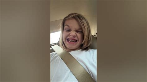 Braces 😬 Follow Youtube